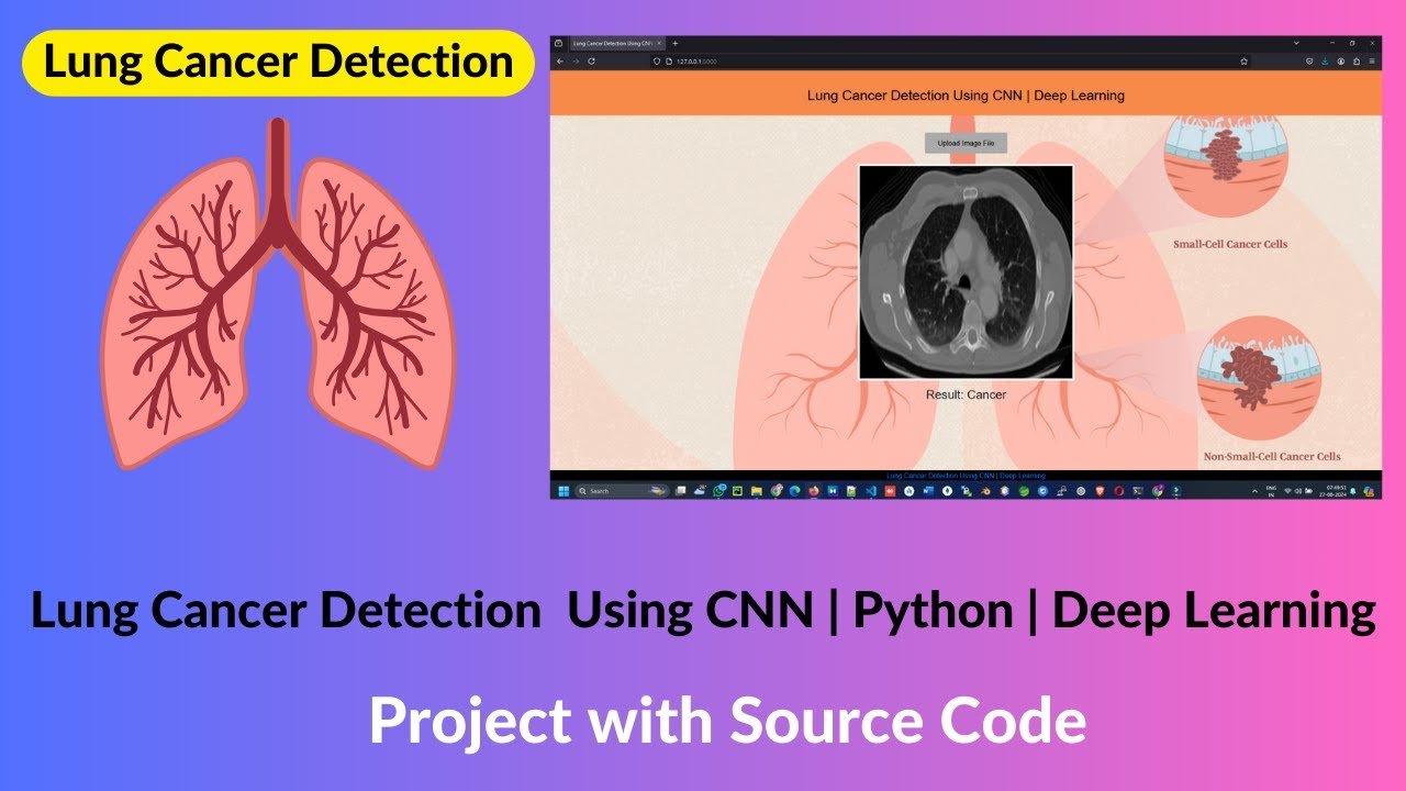 Lung Cancer Detection Using Cnn Project With Source Code Projectworlds